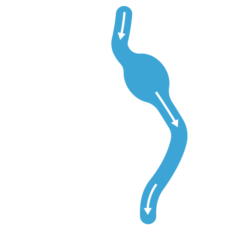 Gastric Bypass Lakeland Regional Health